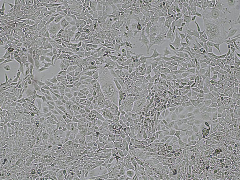 RENCA Luciferase Reporter Cell Line|AcceGen