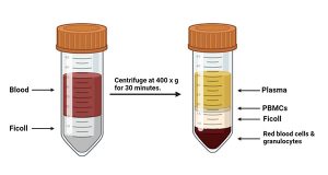 Human Peripheral Blood Mononuclear Cells Preparation and ...